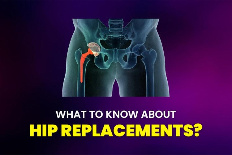 What to know about hip replacements? - Best Visible